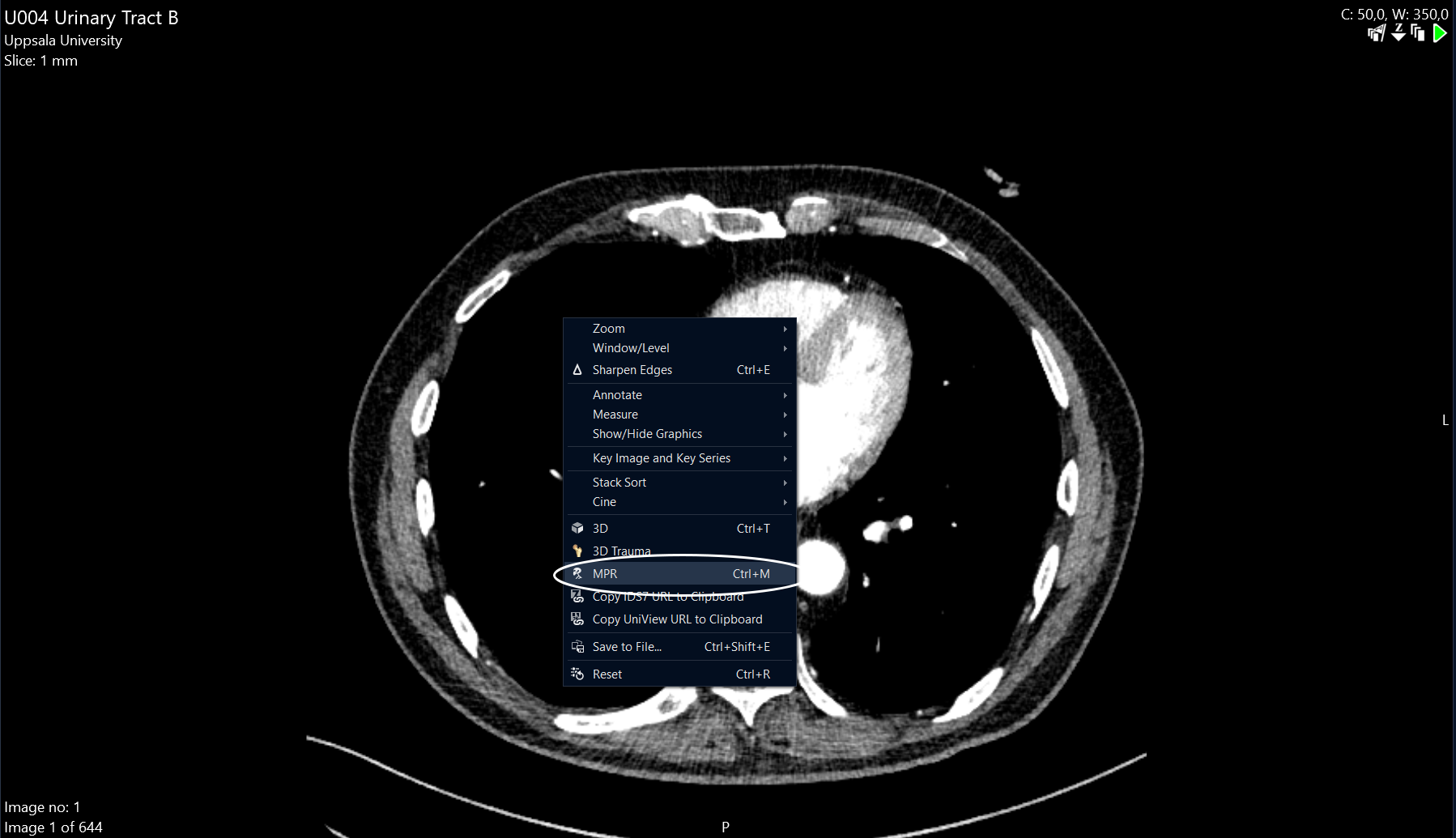 Multiplanar reconstruction (MPR) – Resource Hub Multiplanar reconstruction (MPR) – Resource Hub