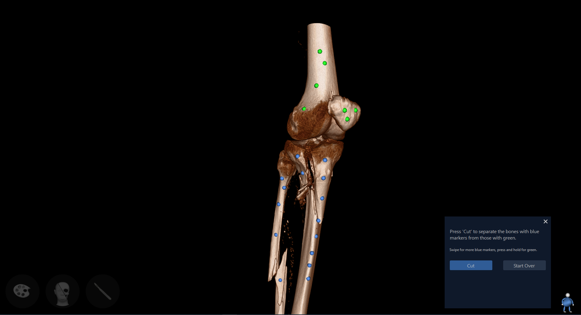 Bone Segmentation Resource Hub