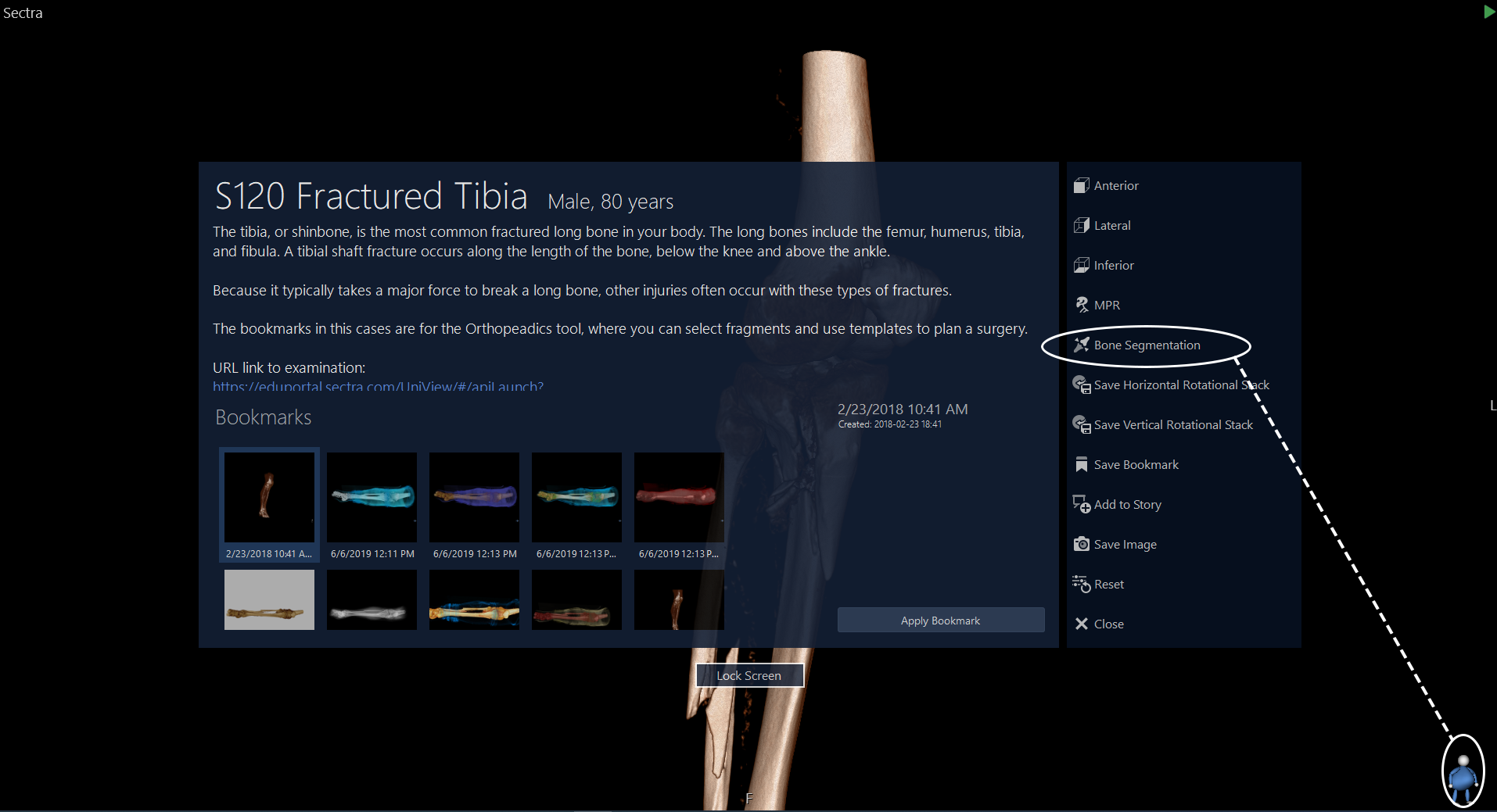 Bone Segmentation Resource Hub